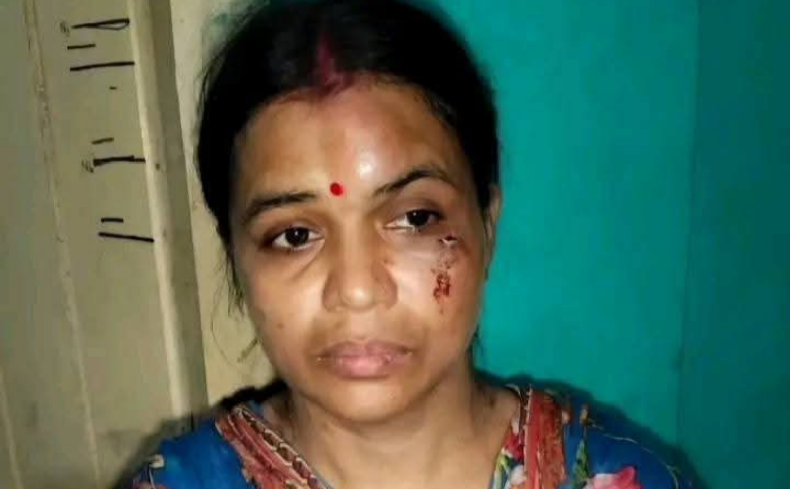 Bangladesh: A minority Hindu family lost everything as armed robbers broke into the house in ...